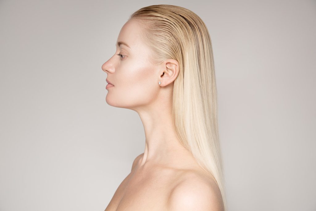 Hairline Restoration in Dallas using SmartGraft® FUE