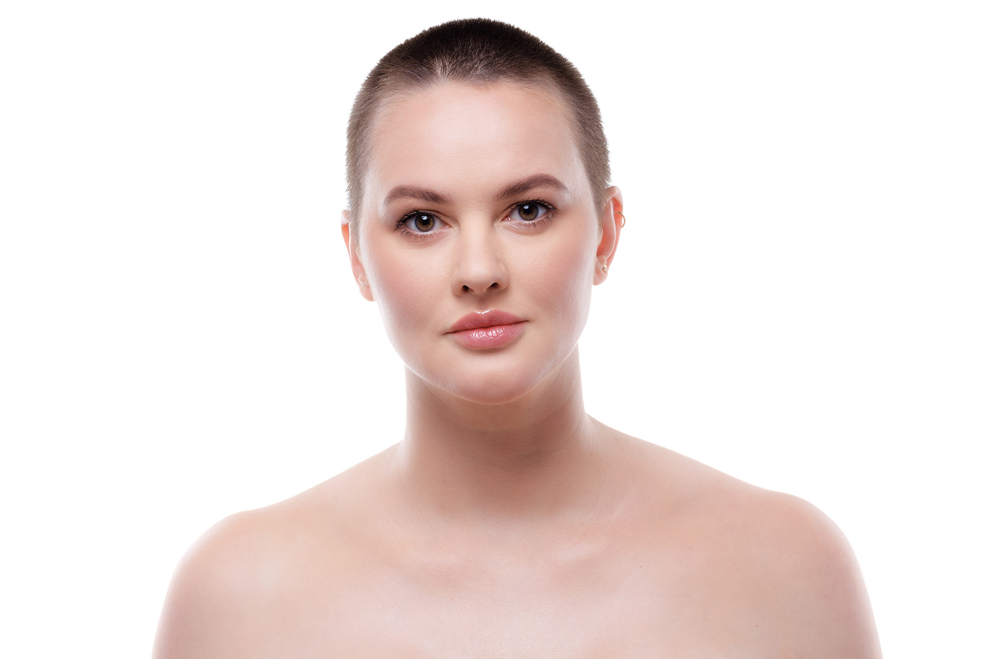 Transgender Masculinization FTM Hair Transplant | Dallas